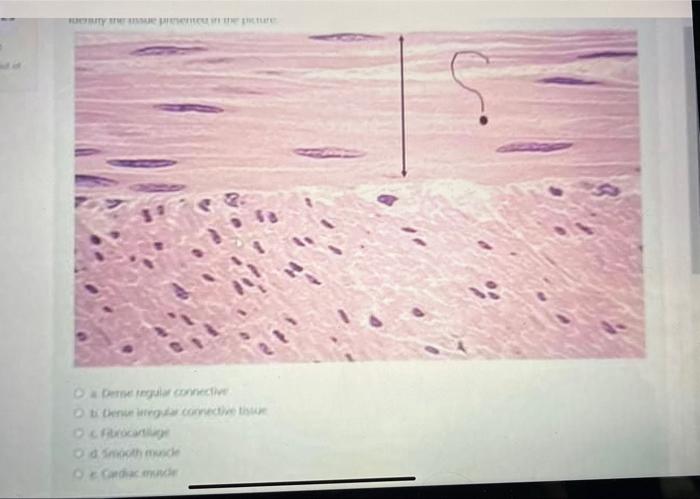 Solved Ty the sue presente in the picture O Derse regular | Chegg.com