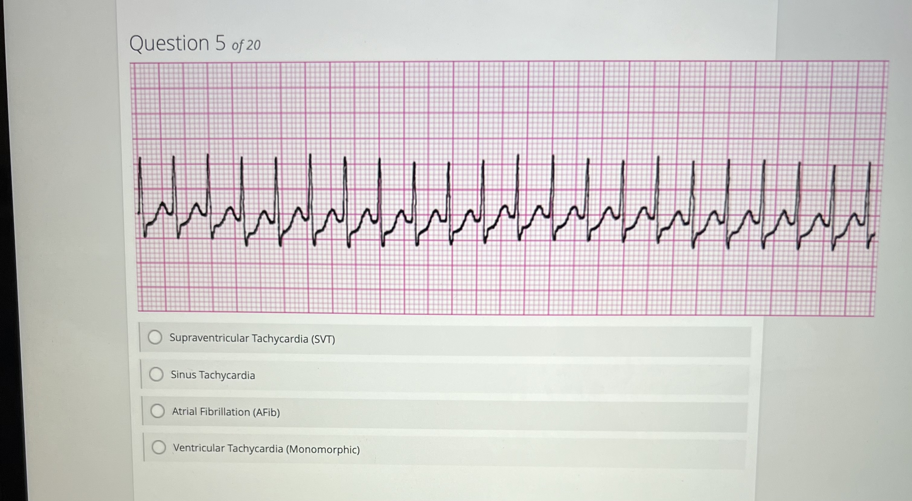 Question 5 ﻿of 20Supraventricular Tachycardia | Chegg.com