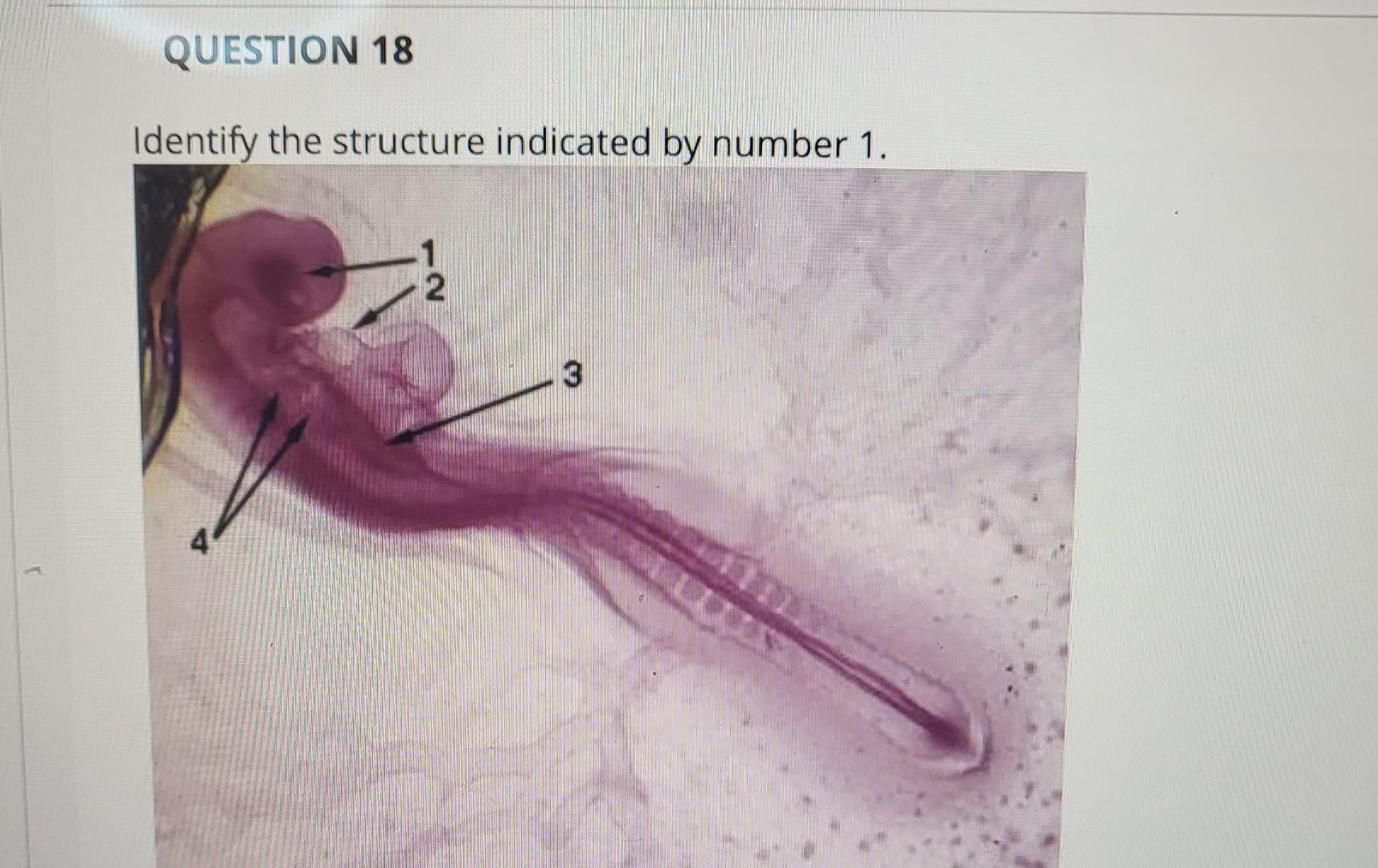 Solved Identify the structure indicated in number | Chegg.com Solved Identify the structure indicated in number | Chegg.com