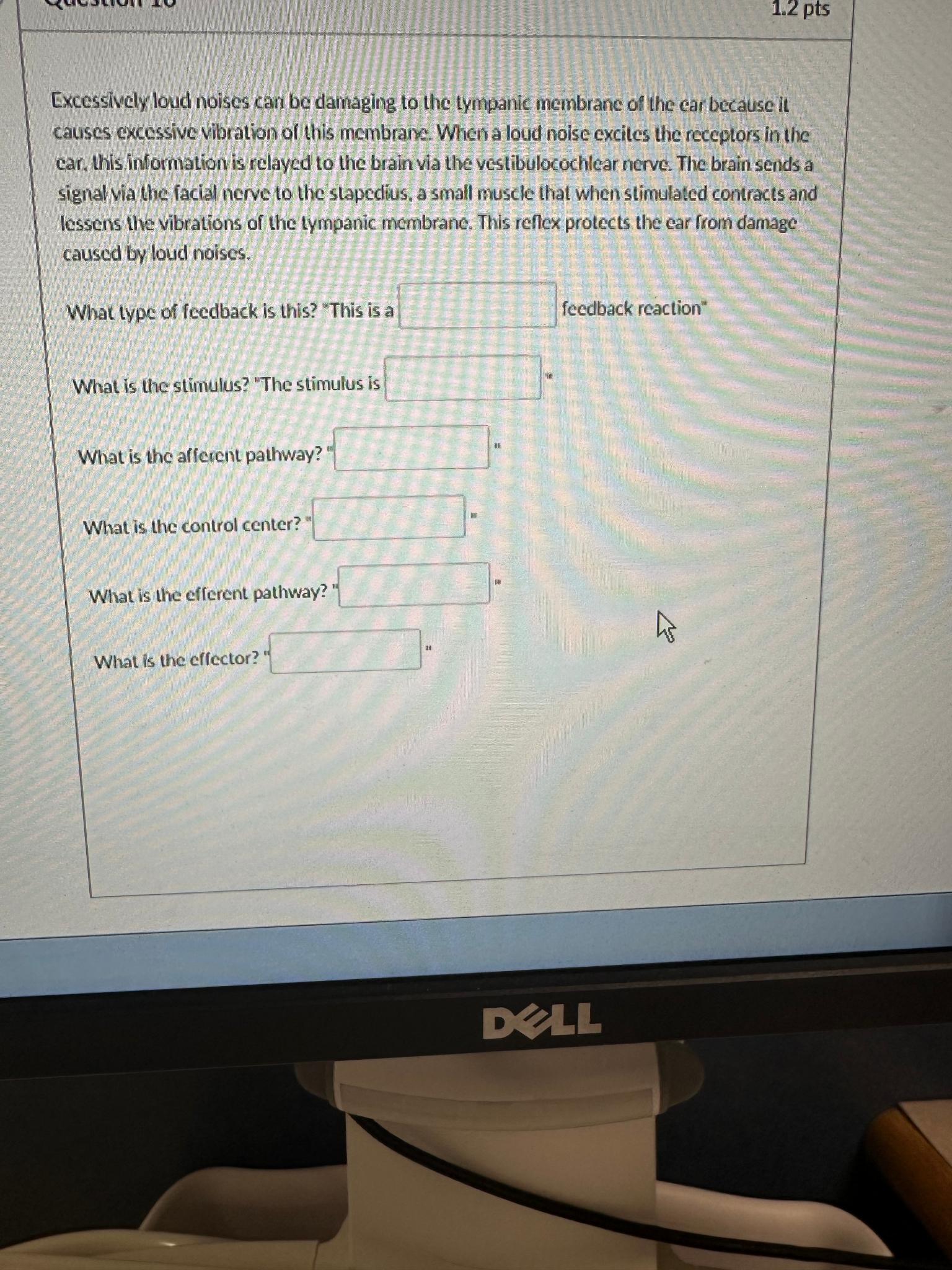 Solved Excessively loud noises can be damaging to the | Chegg.com