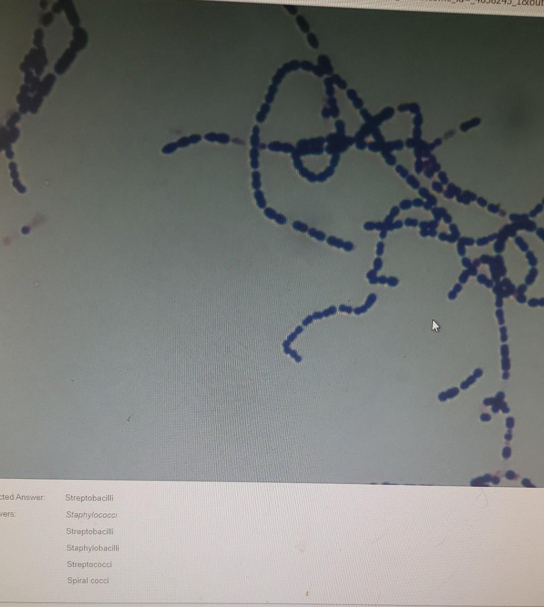 Solved cted Answer: Streptobacilli vers Staphylococc | Chegg.com