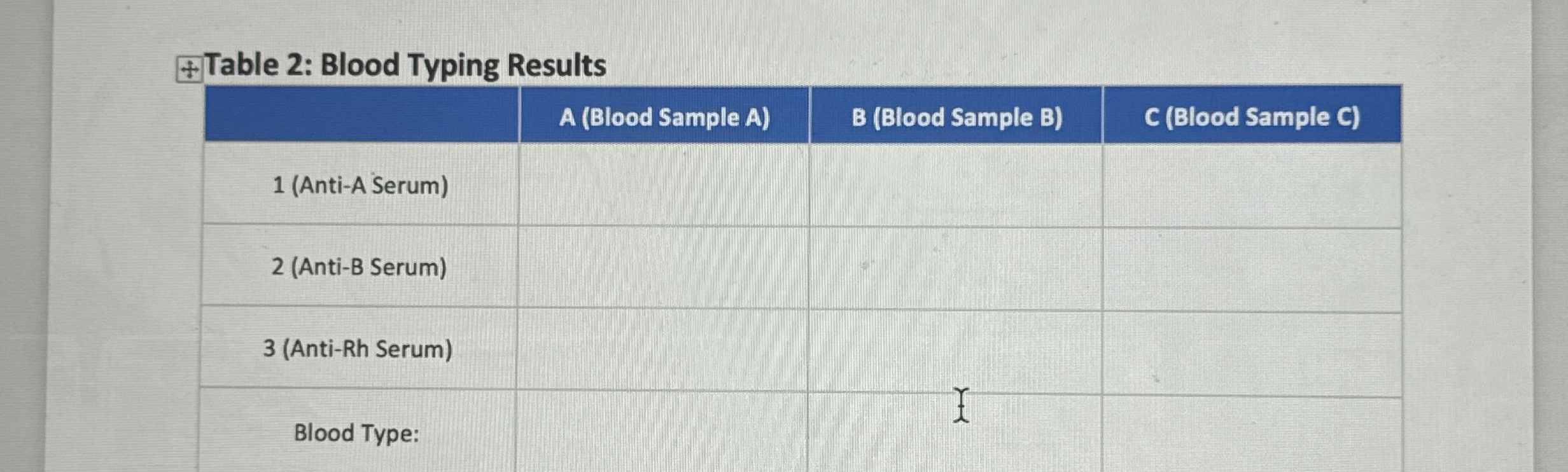 Solved Table 2: Blood Typing Results\table[[,A (Blood Sample | Chegg.com