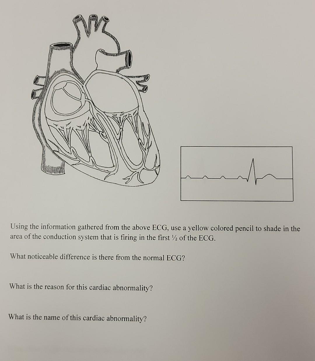 Solved Using the information gathered from the above ECG, | Chegg.com