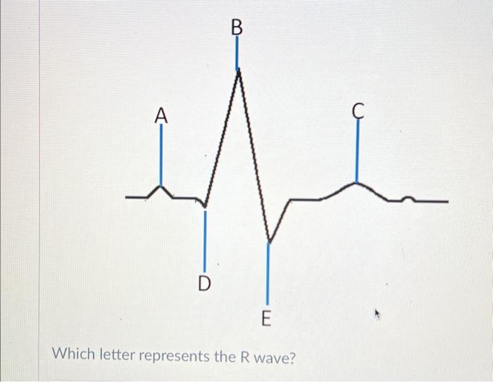 Solved Which letter represents the R wave? | Chegg.com