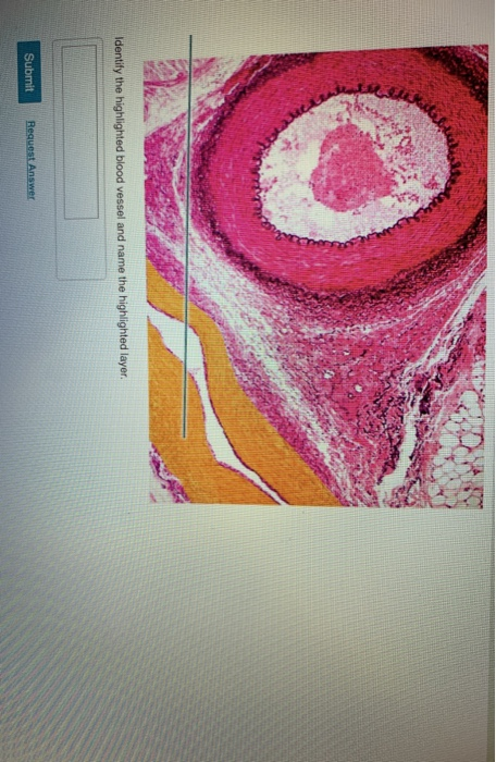 Solved Identify the highlighted vessel. Submit Request | Chegg.com