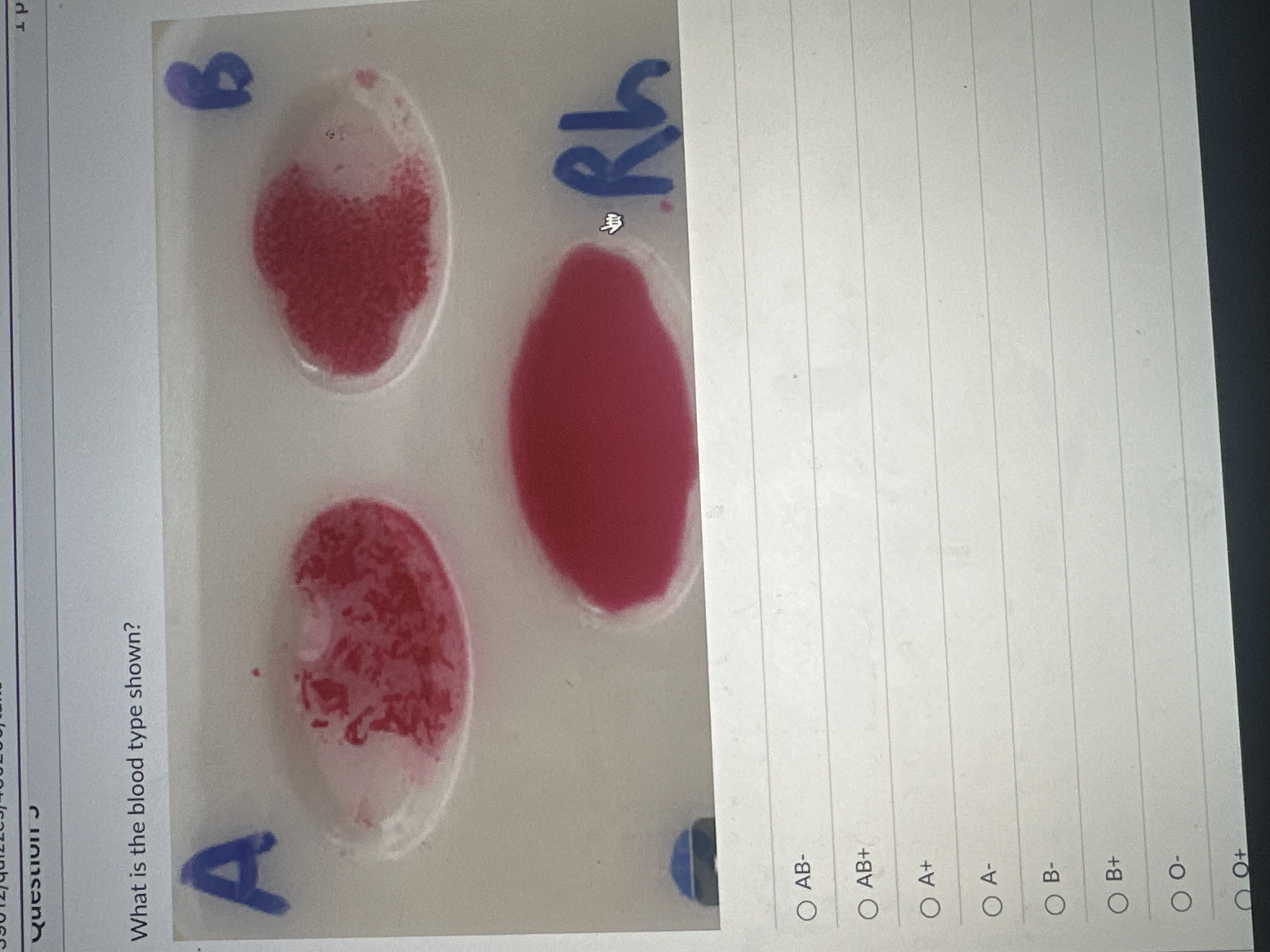 Solved What is the blood type shown?AB-AB+AtA-B-B+O-O+ | Chegg.com