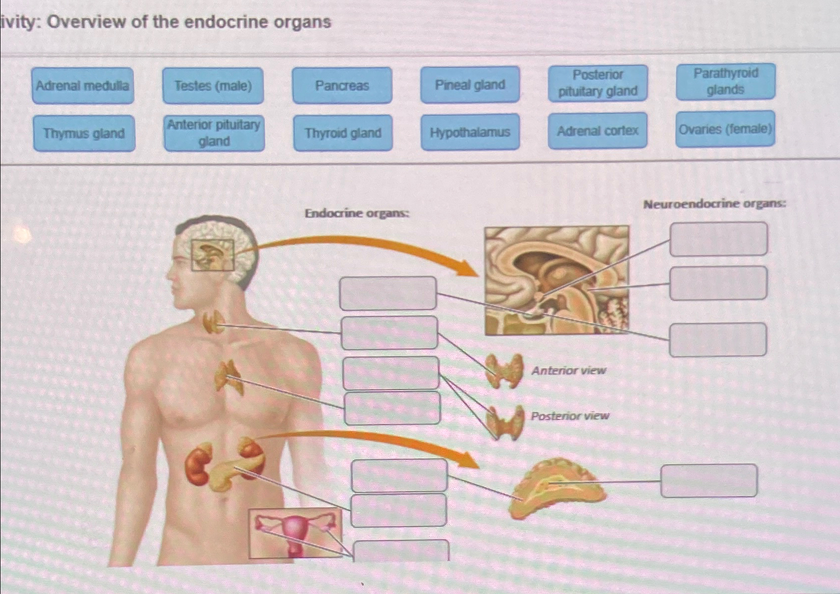 Solved ivity: Overview of the endocrine organs | Chegg.com