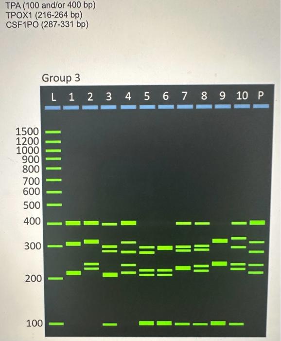 TPA (100 and/or 400bp ) TPOX1 (216-264 bp) CSF1PO | Chegg.com