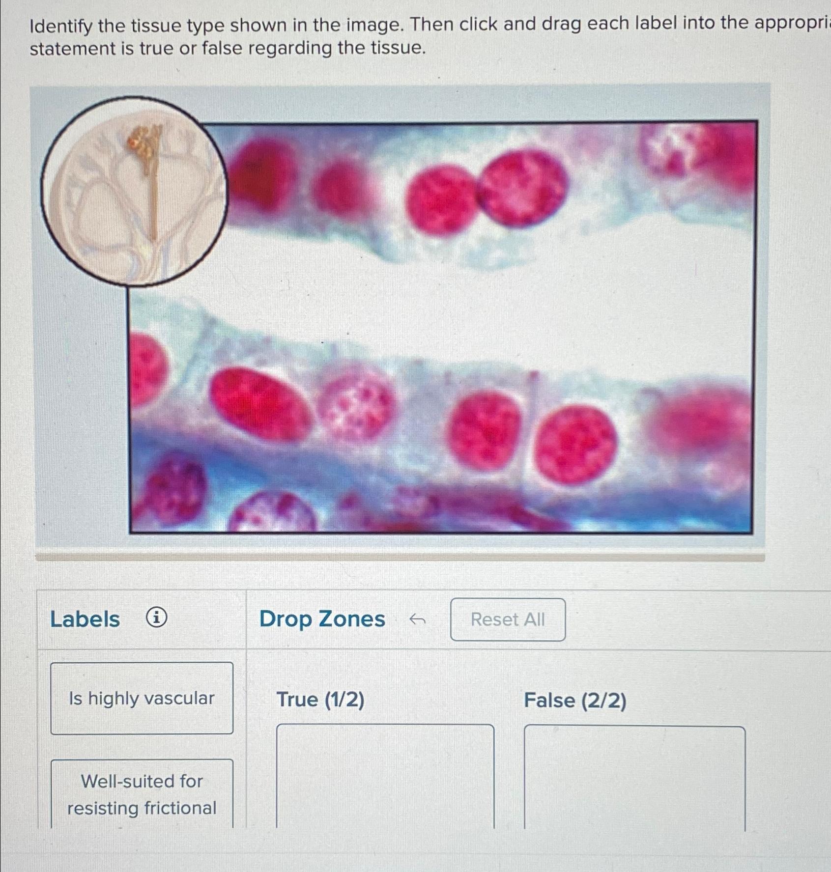 Solved Identify the tissue type shown in the image. Then | Chegg.com
