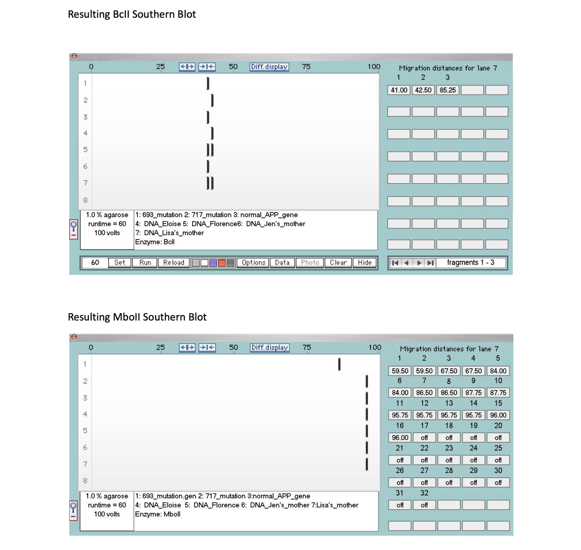 Solved Alzheimer disease is by far the most common cause of | Chegg.com