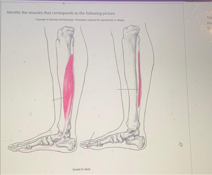 Solved Identify the muscles that corresponds to the | Chegg.com