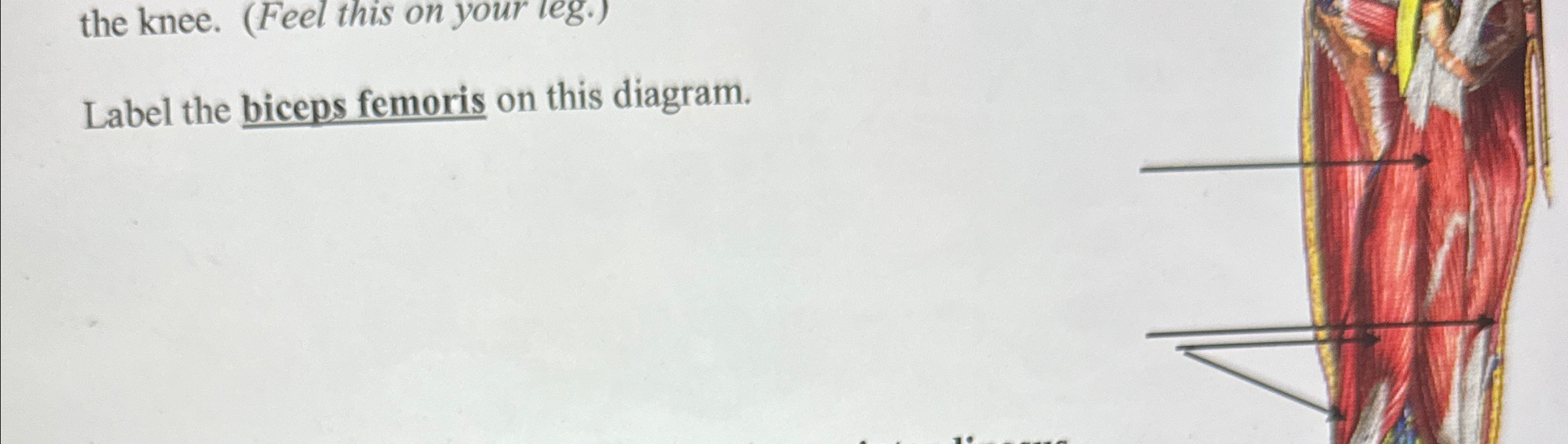 Solved the knee. (Feel this on your leg.)Label the biceps | Chegg.com