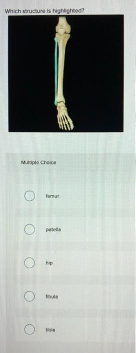Solved Which structure is highlighted? Multiple Choice O | Chegg.com