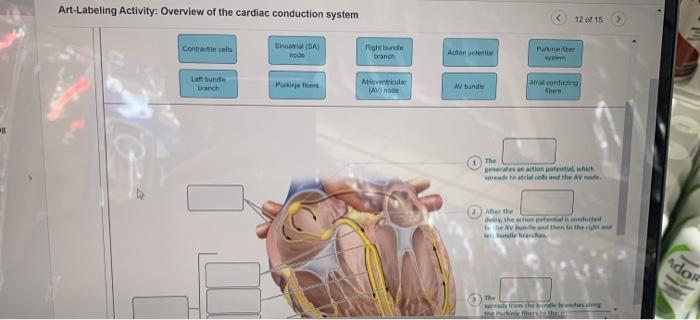 Art-Labeling Activity: Overview of the cardiac | Chegg.com
