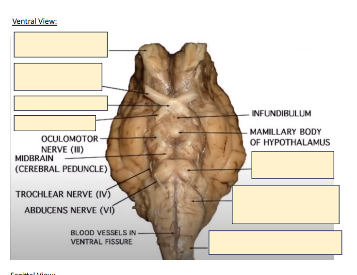Solved Label each box with its corresponding name of part of | Chegg.com