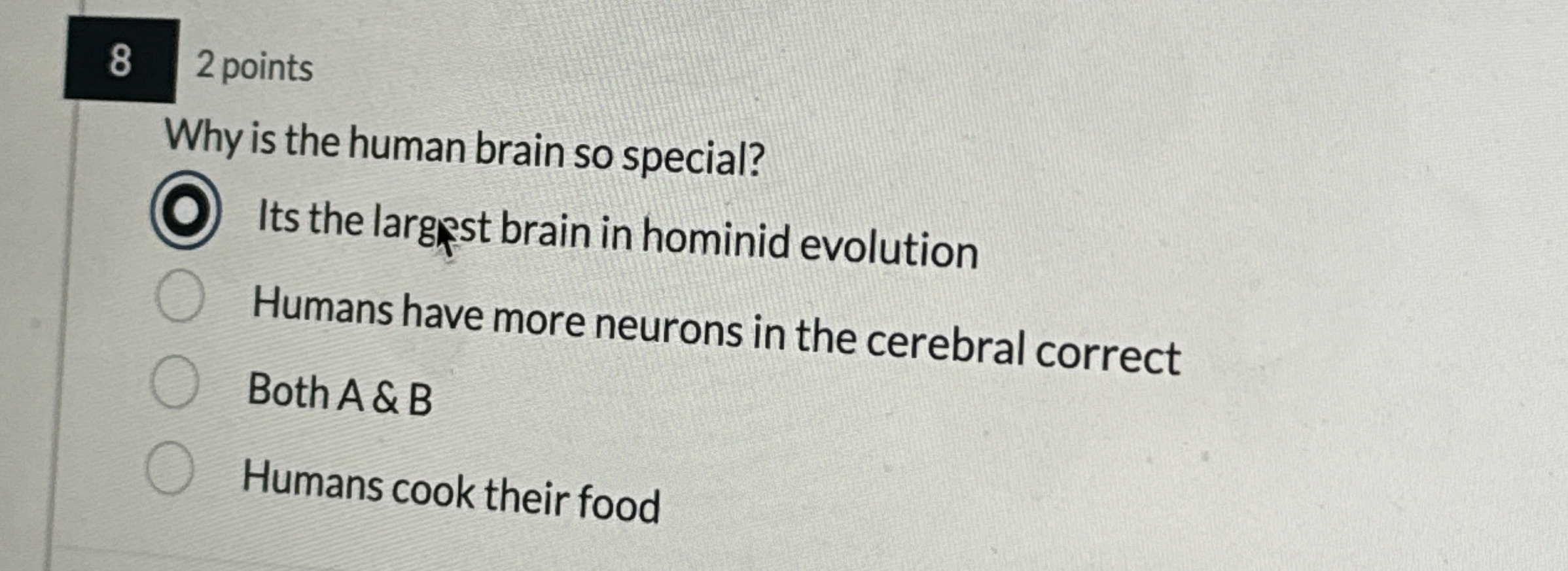 Solved Why is the human brain so special?Its the largest | Chegg.com