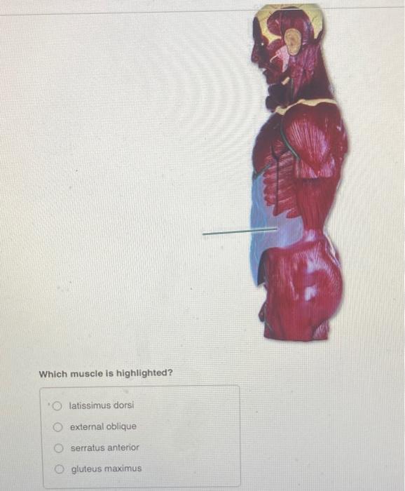 Solved Identify the highlighted muscle. Which muscle is | Chegg.com