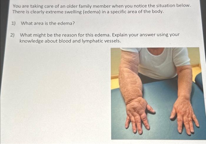 Solved You are taking care of an older family member when | Chegg.com