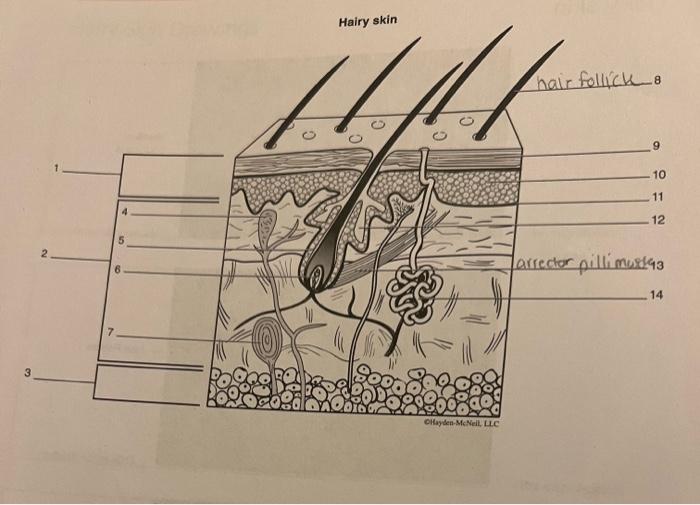 Solved Skin of the Armnit wos not have LSkin Label the | Chegg.com