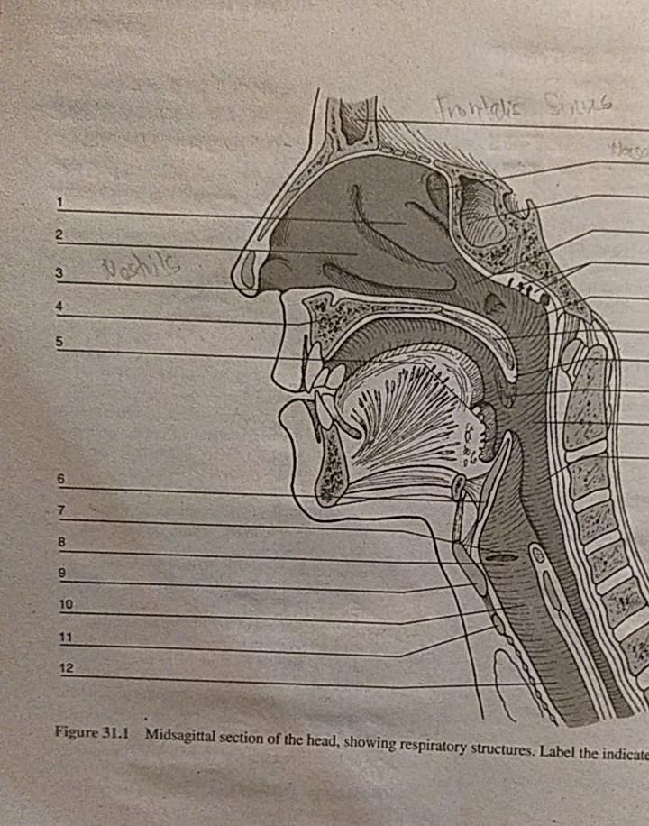 Solved Frontals Sinus 2 3 5 6 7 8 10 12 Figure 31.1 | Chegg.com