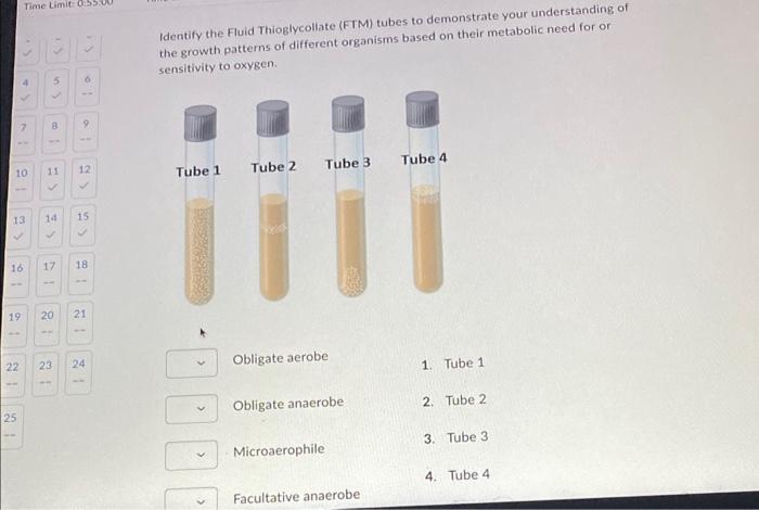 Solved Identify the Fluid Thioglycollate (FTM) tubes to | Chegg.com