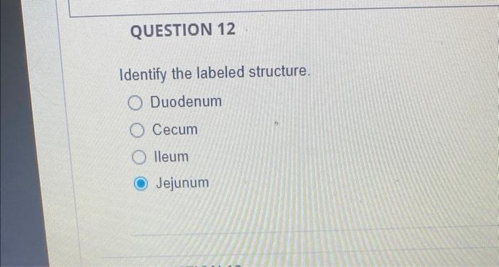 Solved Identify the labeled structure. Duodenum Cecum lleum | Chegg.com