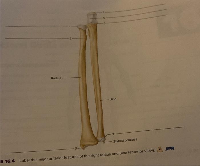Solved Radius Uina Styloid process E 16.4 Label the major | Chegg.com