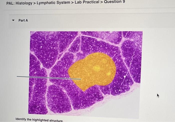Solved PAL: Histology > Lymphatic System > Lab Practical > | Chegg.com