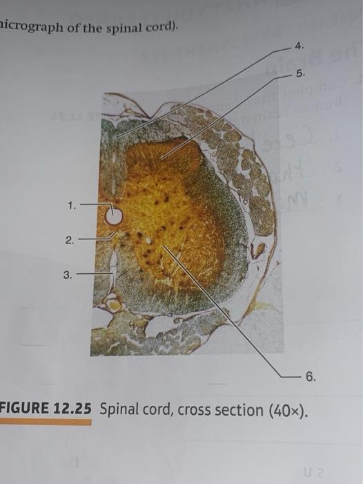 Solved micrograph of the spinal cord). 4. 5. 1. M 2. V 3. 6. | Chegg.com