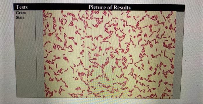 Solved Your unknown bacteria sample is one of the following | Chegg.com