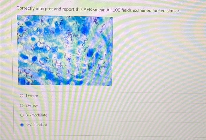 Correctly interpret and report this AFB smear. All | Chegg.com