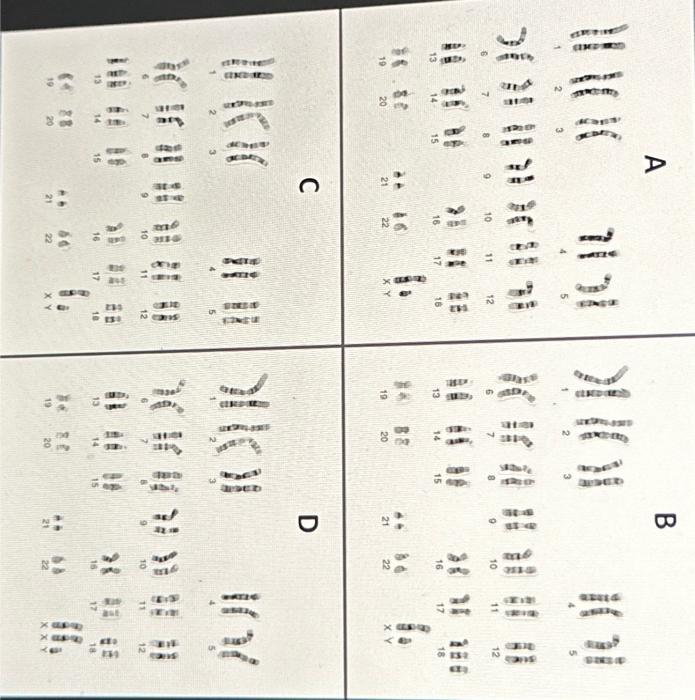 Solved 20111 P karyotype Analysis (Laboratory #6) Use the | Chegg.com