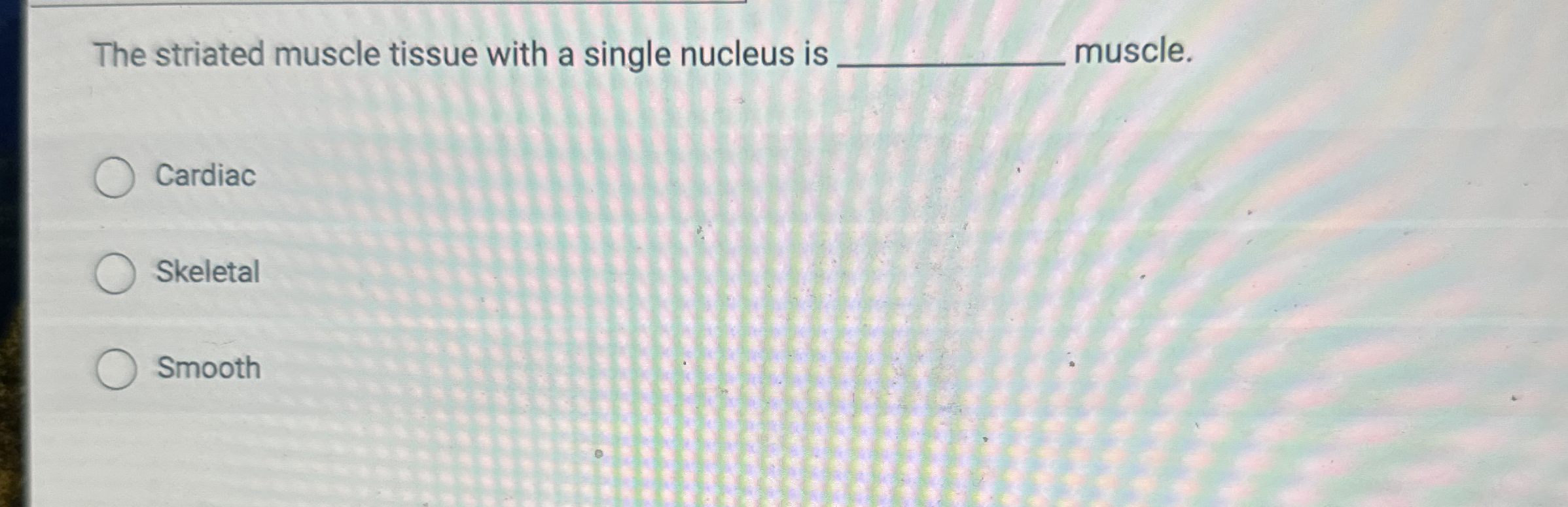 Solved The striated muscle tissue with a single nucleus | Chegg.com