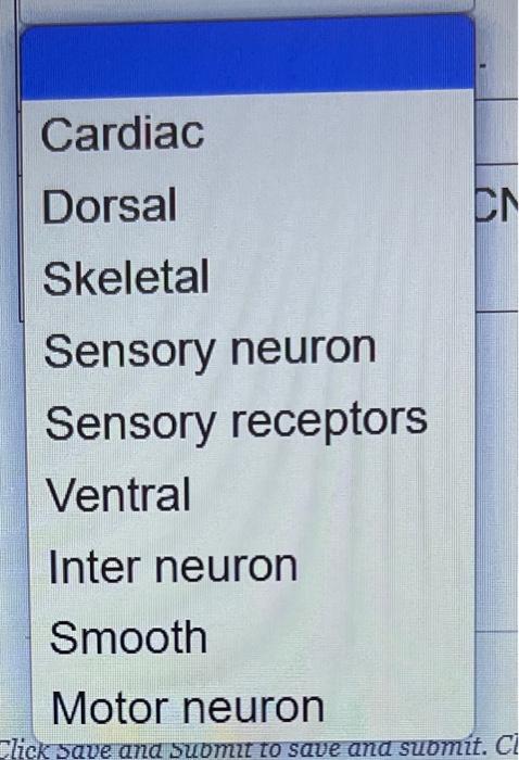 Solved Considar a SOMATIC REFLEX ARC to answer the questans | Chegg.com