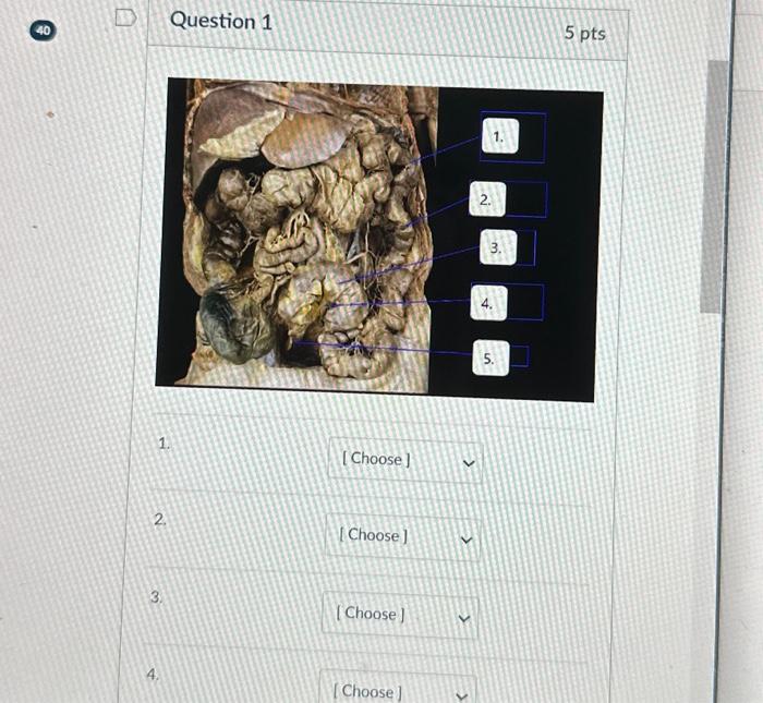 Solved 40 B 0 1. 2. 3. 4. Question 1 [Choose] [Choose] | Chegg.com