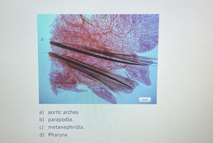 Solved a) aortic arches b) parapodia. c) metanephridia. d) | Chegg.com