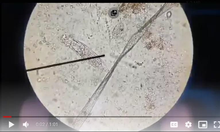 Solved L 4 0:02/ 1:01 CC III. Examination of Live Cells. | Chegg.com