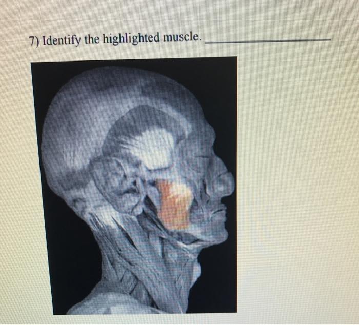 Solved 8) Identify the highlighted muscle. 7) Identify the | Chegg.com