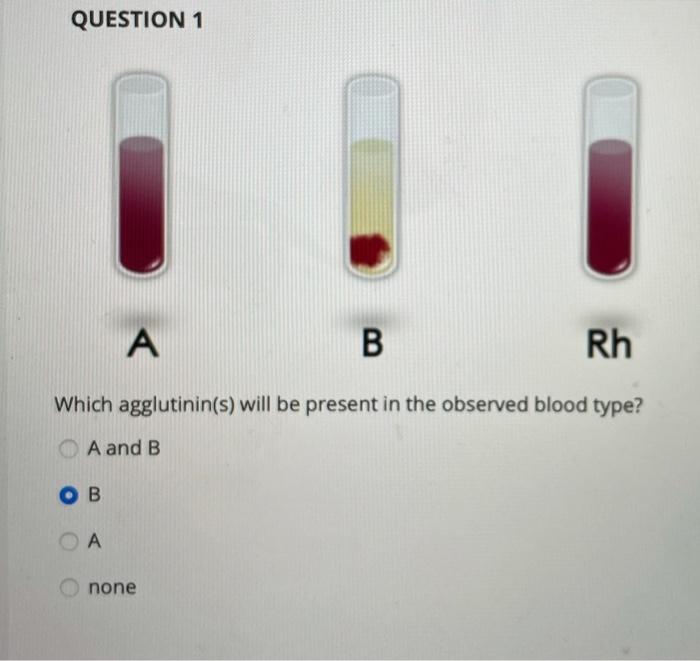Solved QUESTION 4 A B Rh What is the blood type from the | Chegg.com