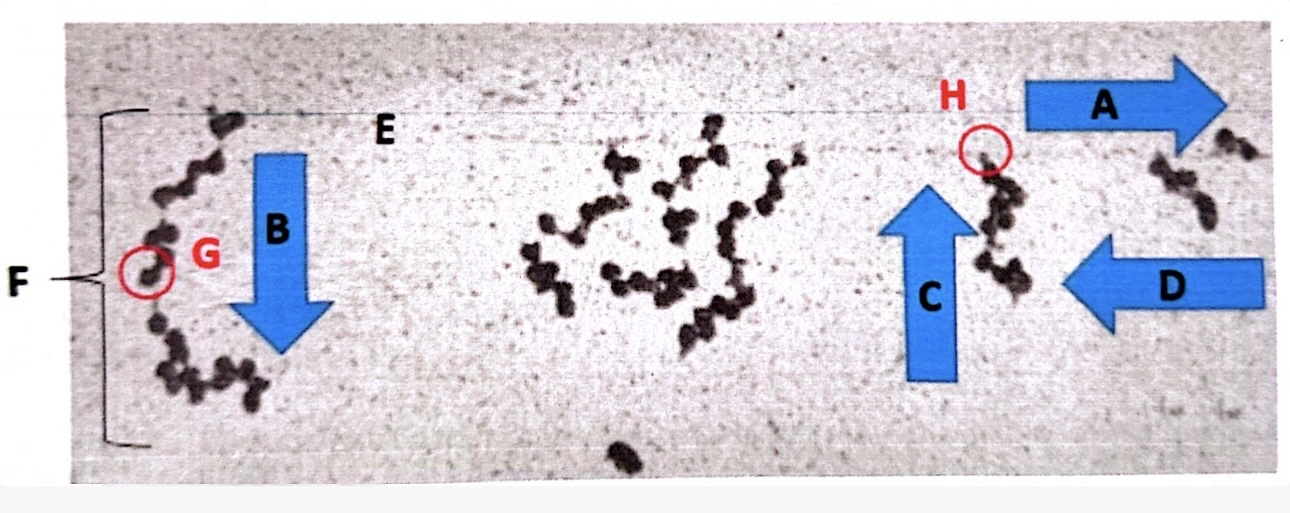 Solved 1. ﻿The picture down below is an electron micrograph | Chegg.com