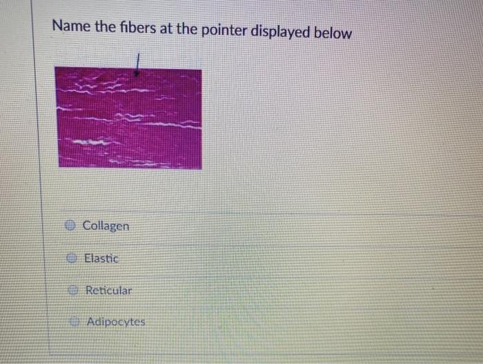 Solved Name the fibers at the pointer displayed below | Chegg.com