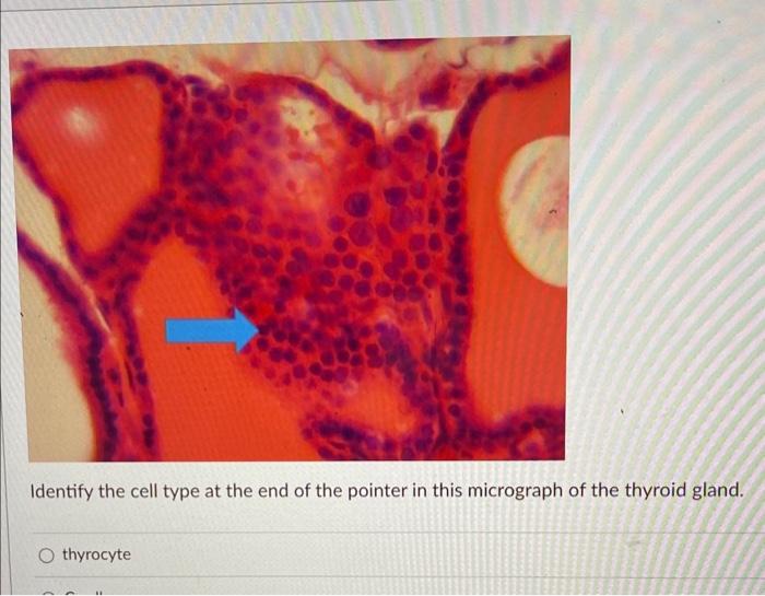 Solved Identify the cell type at the end of the pointer in | Chegg.com