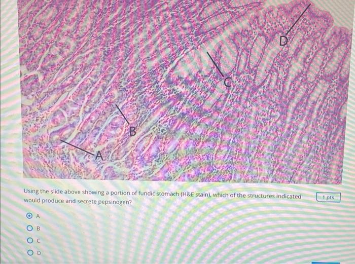 Solved Using the slide above showing a portion of fundic | Chegg.com
