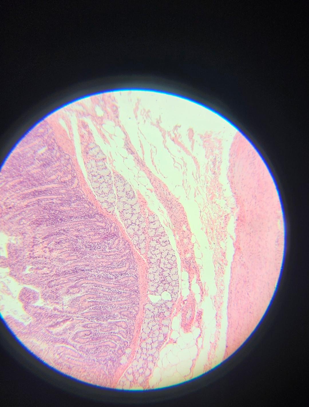 Solved duodenum mucosa submucosa lamina propria Villi micro | Chegg.com