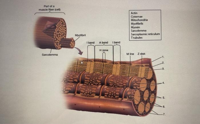Solved Part of a muscle fiber (cell) Actin Cisterna | Chegg.com