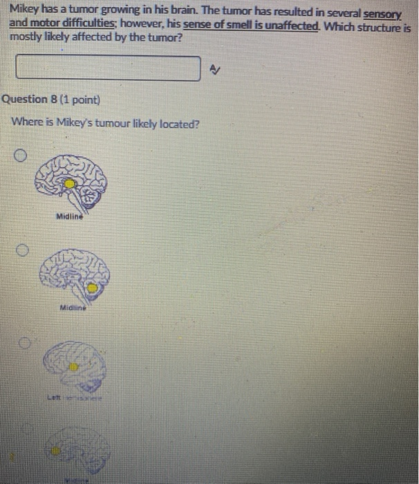 Solved Mikey has a tumor growing in his brain. The tumor has | Chegg.com