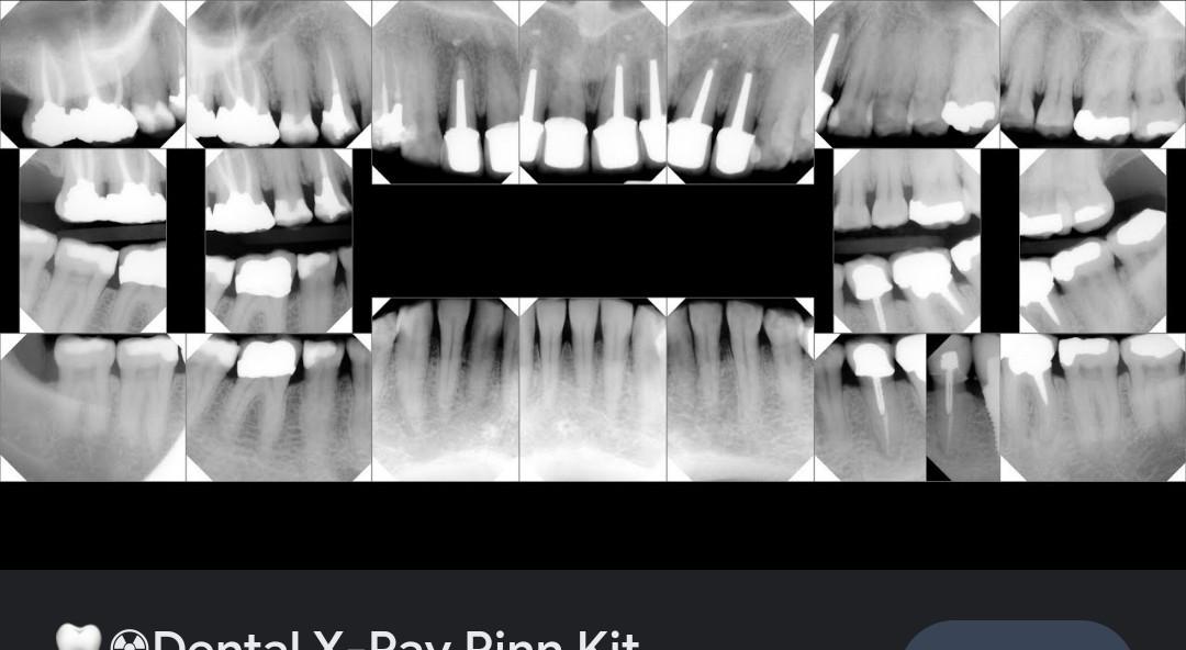 Solved RADIOLOGY. radiographic interpretation Amalgam | Chegg.com