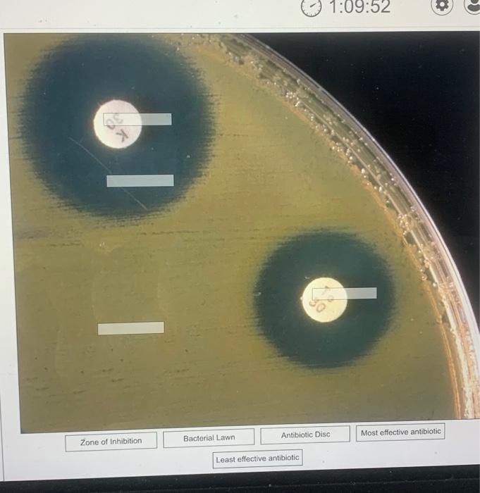 Solved 1:09:52 1 Antibiotic Disc Most effective antibiotic | Chegg.com
