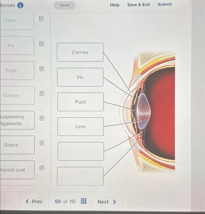 Solved Senses i Saved Help Save \& Exit Submit Lens Iris 圂 | Chegg.com