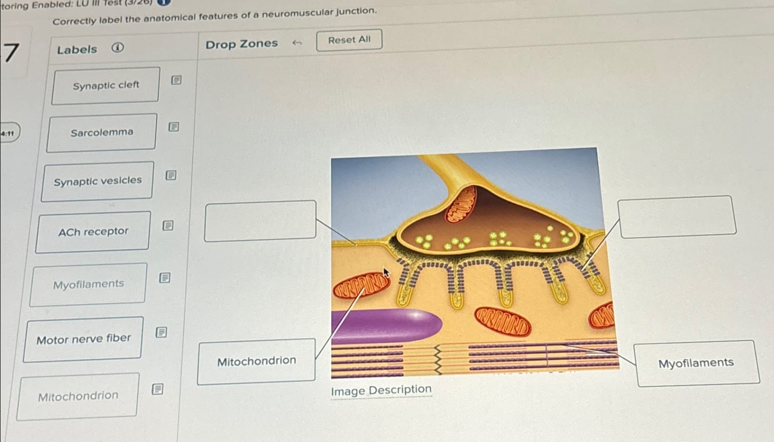 Solved Correctly label the anatomical features of a | Chegg.com